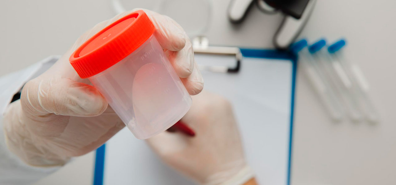 Espermograma: Entenda tudo sobre o exame - Dr. Alexandre Rossani